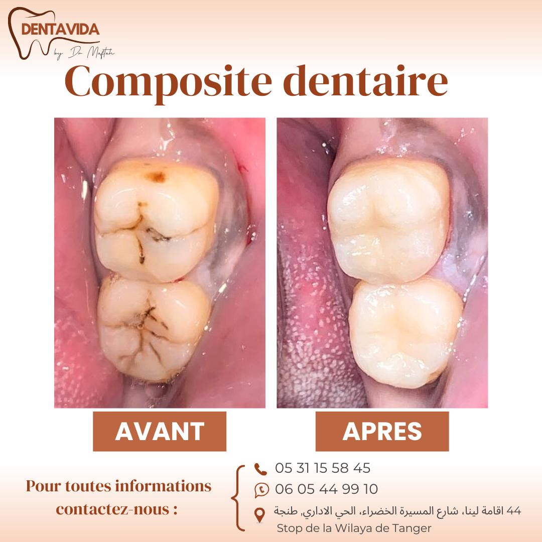 Centre Dentaire Tanger de Dr Hajar Maftah - Dentiste Tanger